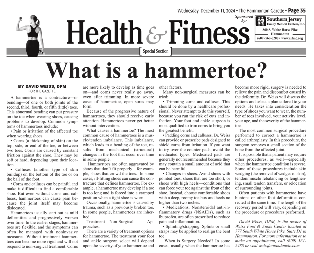 What is a hammertoe? - Weiss Foot & Ankle Center